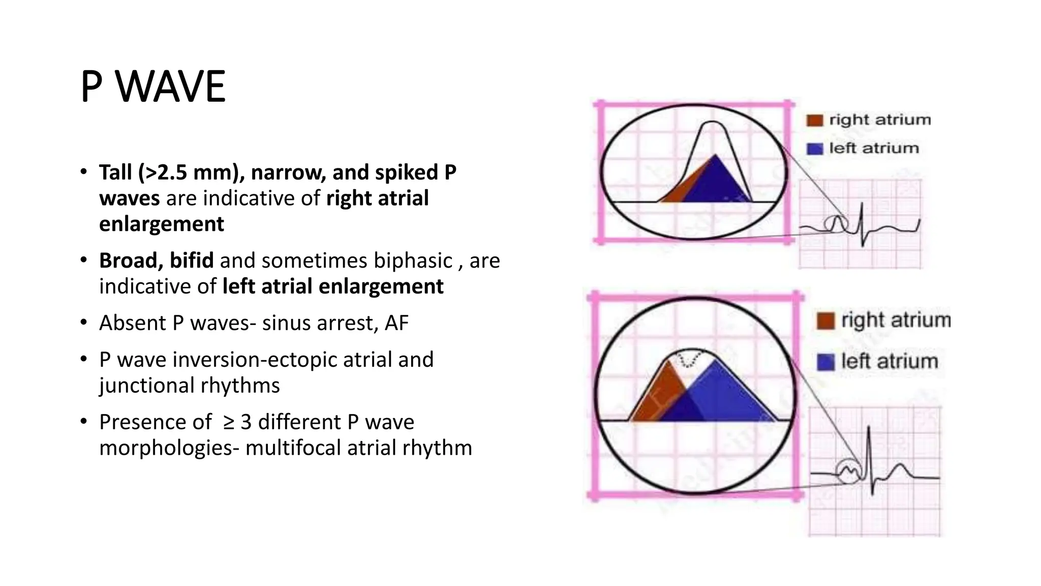 Basics of ECG.pptx