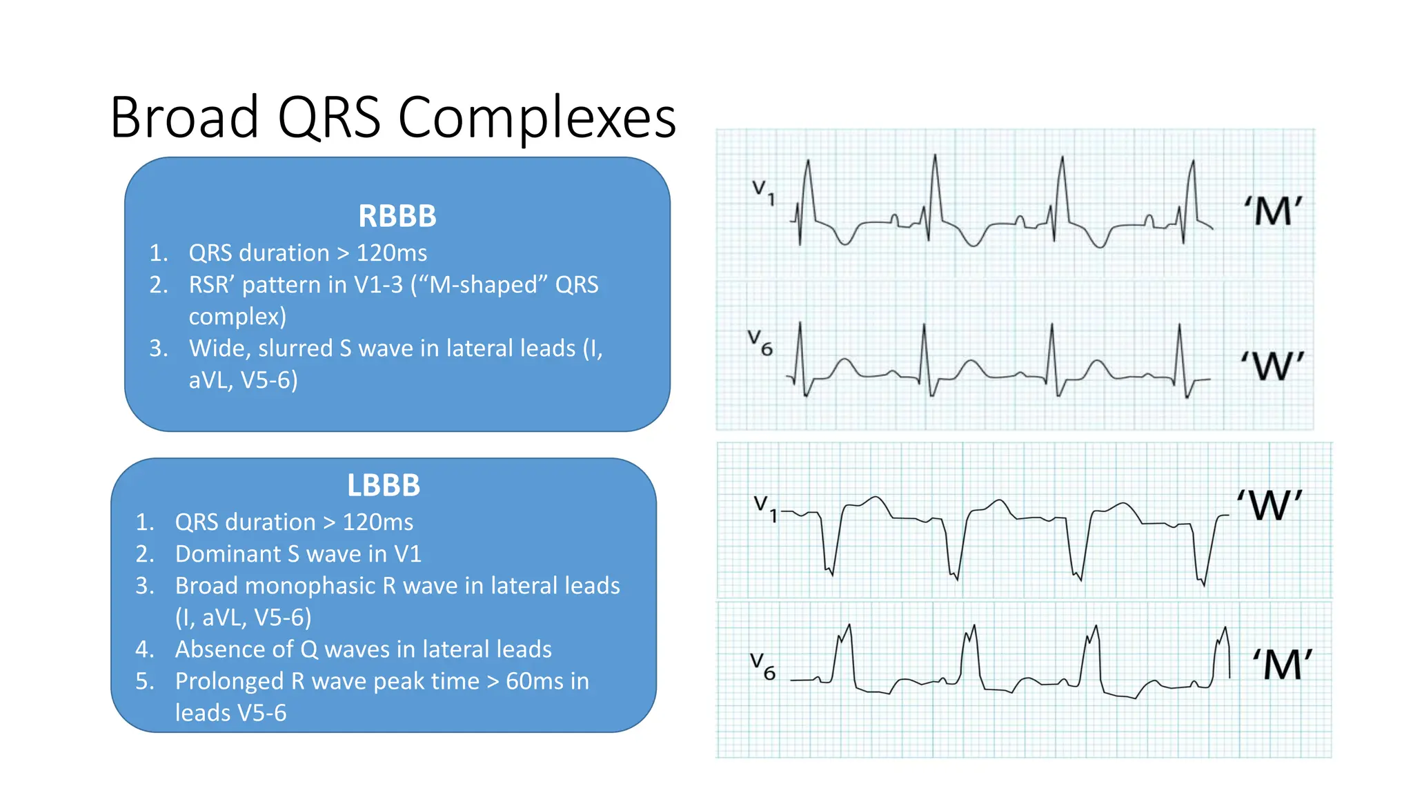 Basics of ECG.pptx