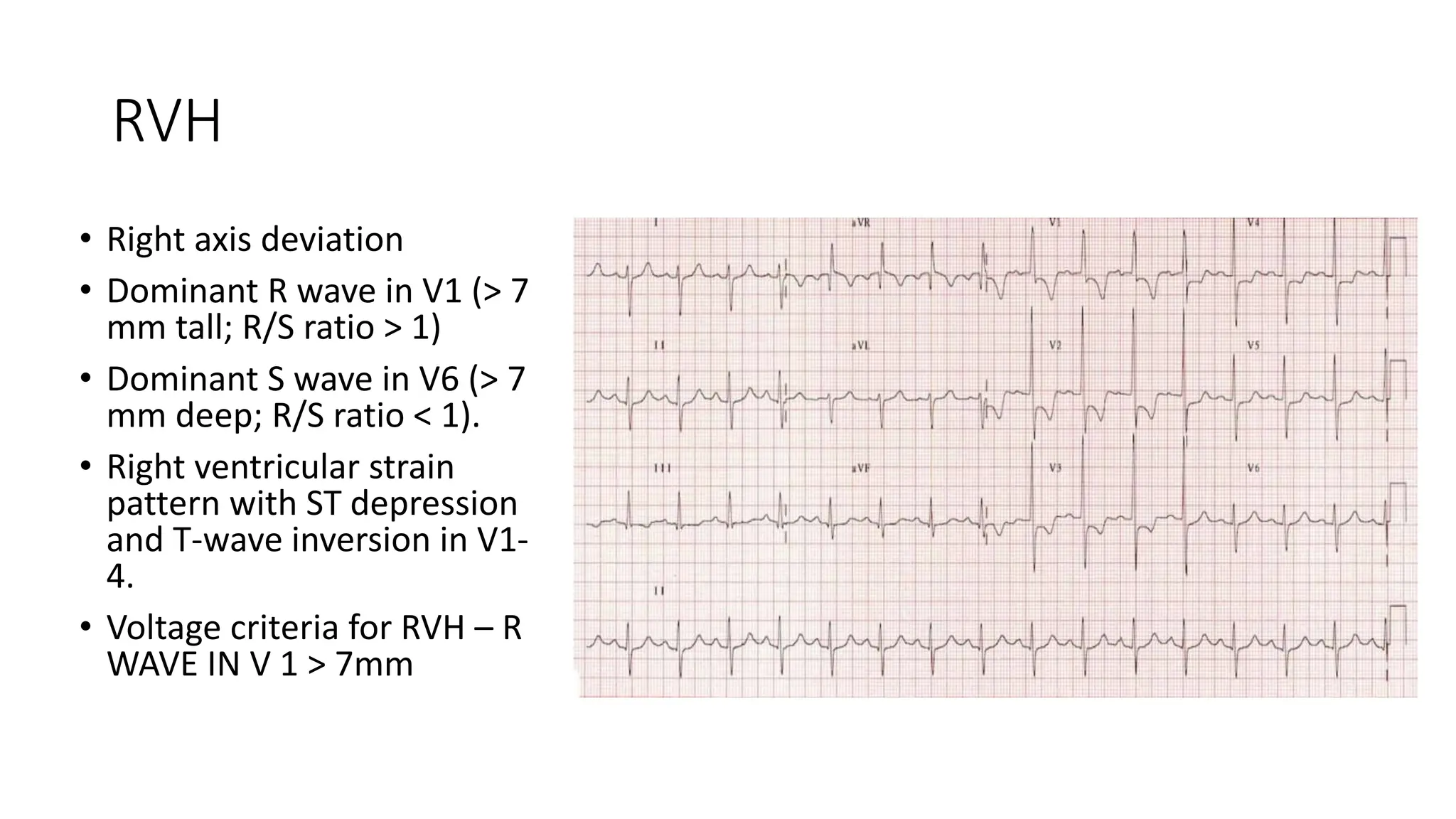 Basics of ECG.pptx
