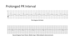 Basics of ECG.pptx
