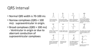 Basics of ECG.pptx