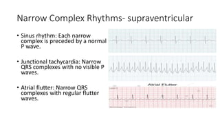 Basics of ECG.pptx