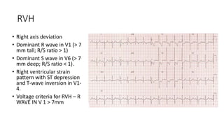 Basics of ECG.pptx
