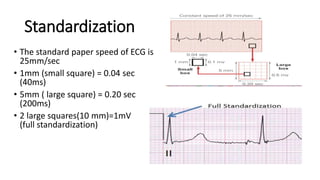 Basics of ECG.pptx