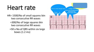 Basics of ECG.pptx