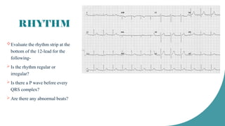 BASICS OF ECGBASICS OF ECGBASICS OF ECGBASICS OF ECG | PPT