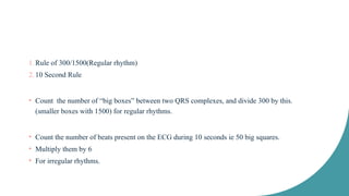 BASICS OF ECGBASICS OF ECGBASICS OF ECGBASICS OF ECG | PPTX