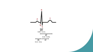 BASICS OF ECGBASICS OF ECGBASICS OF ECGBASICS OF ECG | PPT