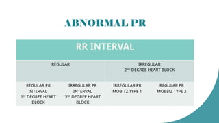 BASICS OF ECGBASICS OF ECGBASICS OF ECGBASICS OF ECG | PPT