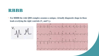 BASICS OF ECGBASICS OF ECGBASICS OF ECGBASICS OF ECG | PPTX