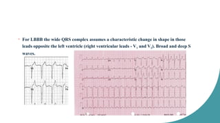 BASICS OF ECGBASICS OF ECGBASICS OF ECGBASICS OF ECG | PPT