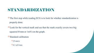 BASICS OF ECGBASICS OF ECGBASICS OF ECGBASICS OF ECG | PPT