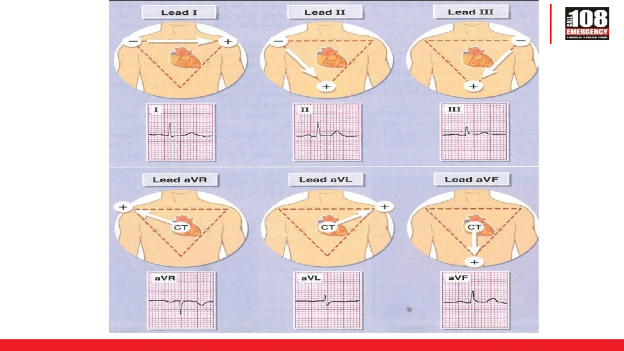 Basics of ECG and interpretation andd ho | PPTX