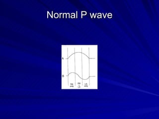 Basics of ECG.ppt dr.k.subramanyam | PPT