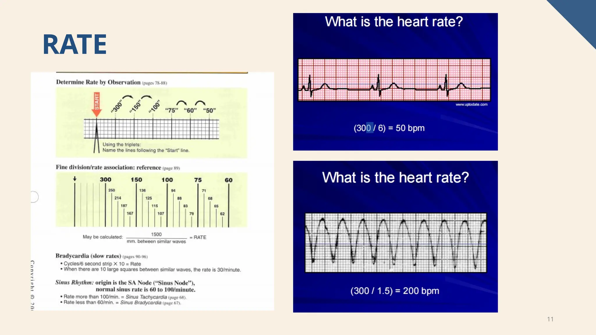 Basics of Electro Cardio Gram Interpretation.pptx