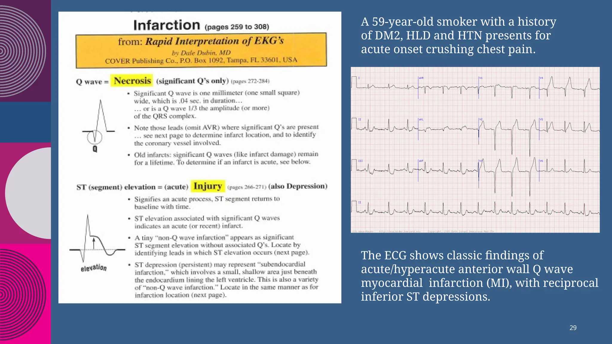 Basics of Electro Cardio Gram Interpretation.pptx