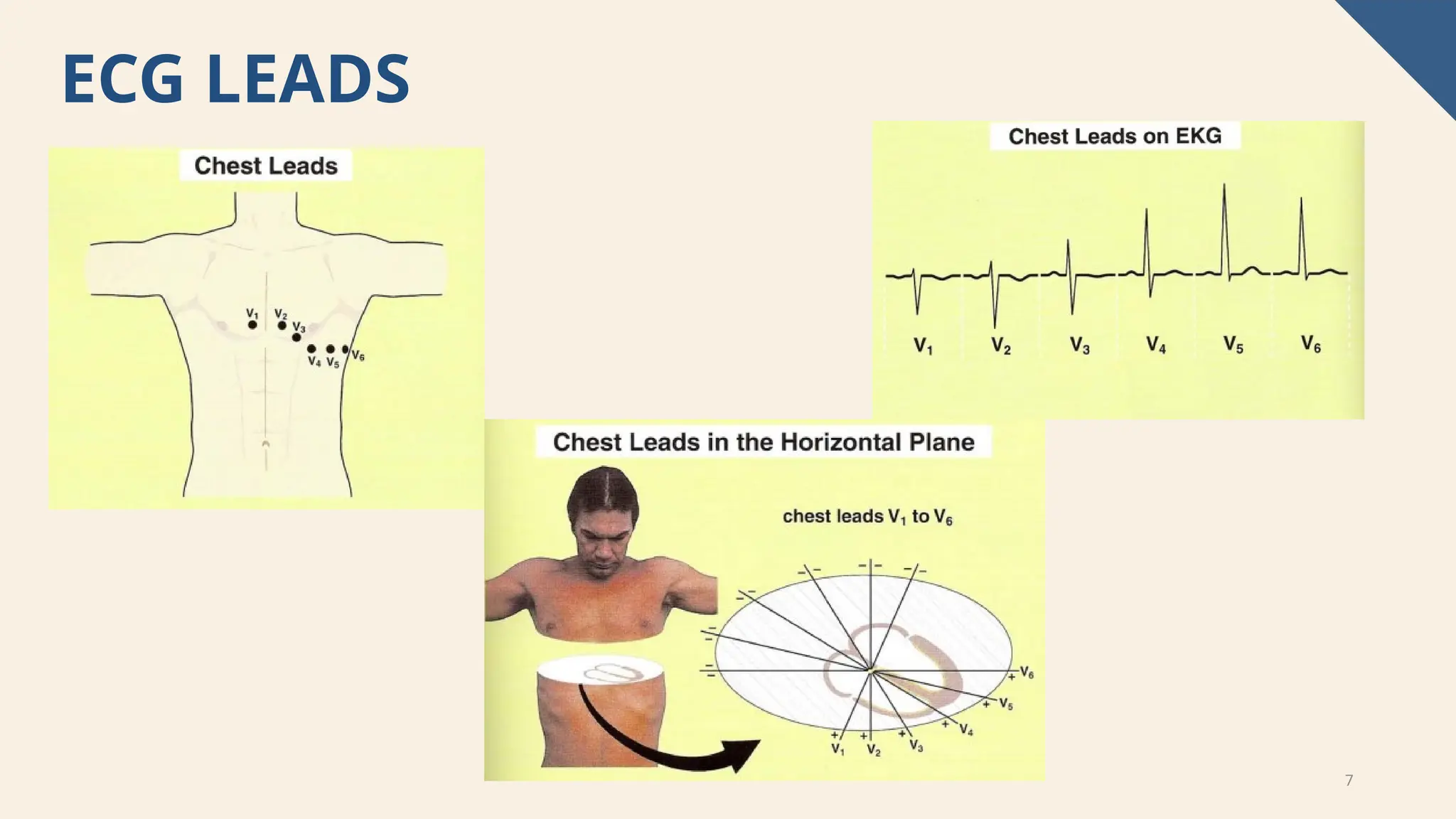 Basics of Electro Cardio Gram Interpretation.pptx
