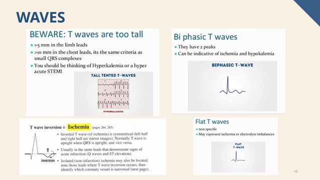 Basics of Electro Cardio Gram Interpretation.pptx