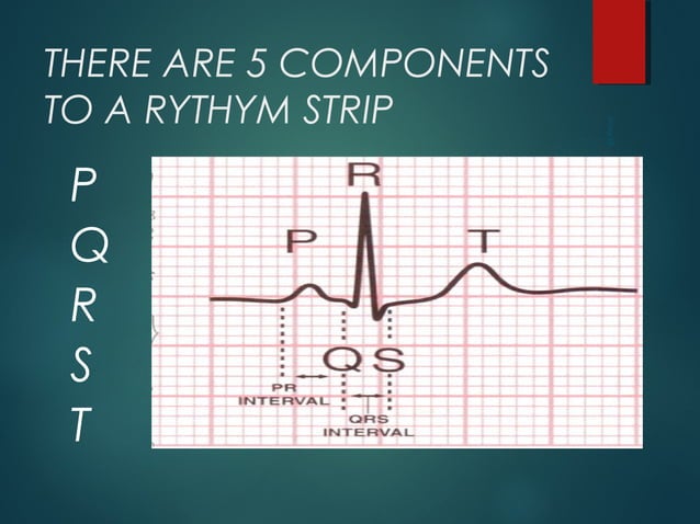 Basics of ecg interpretation by dr sai | PPT