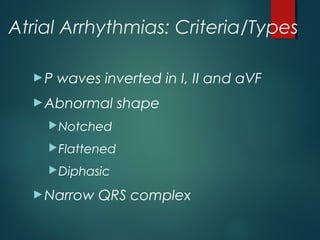 Basics of ecg interpretation by dr sai | PPT