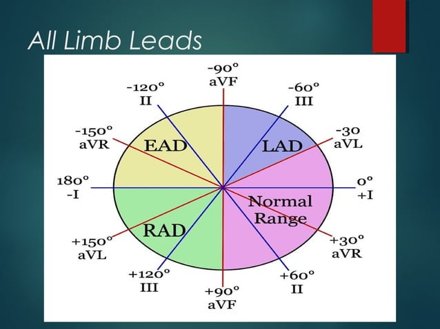 Basics of ecg interpretation by dr sai | PPT