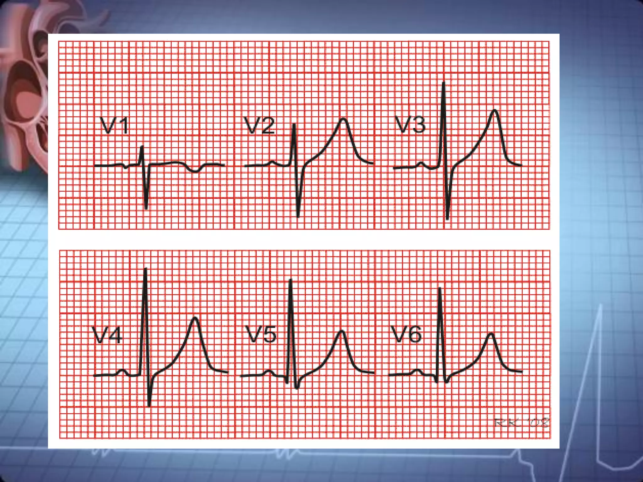 Basics of ECG physiology | PDF