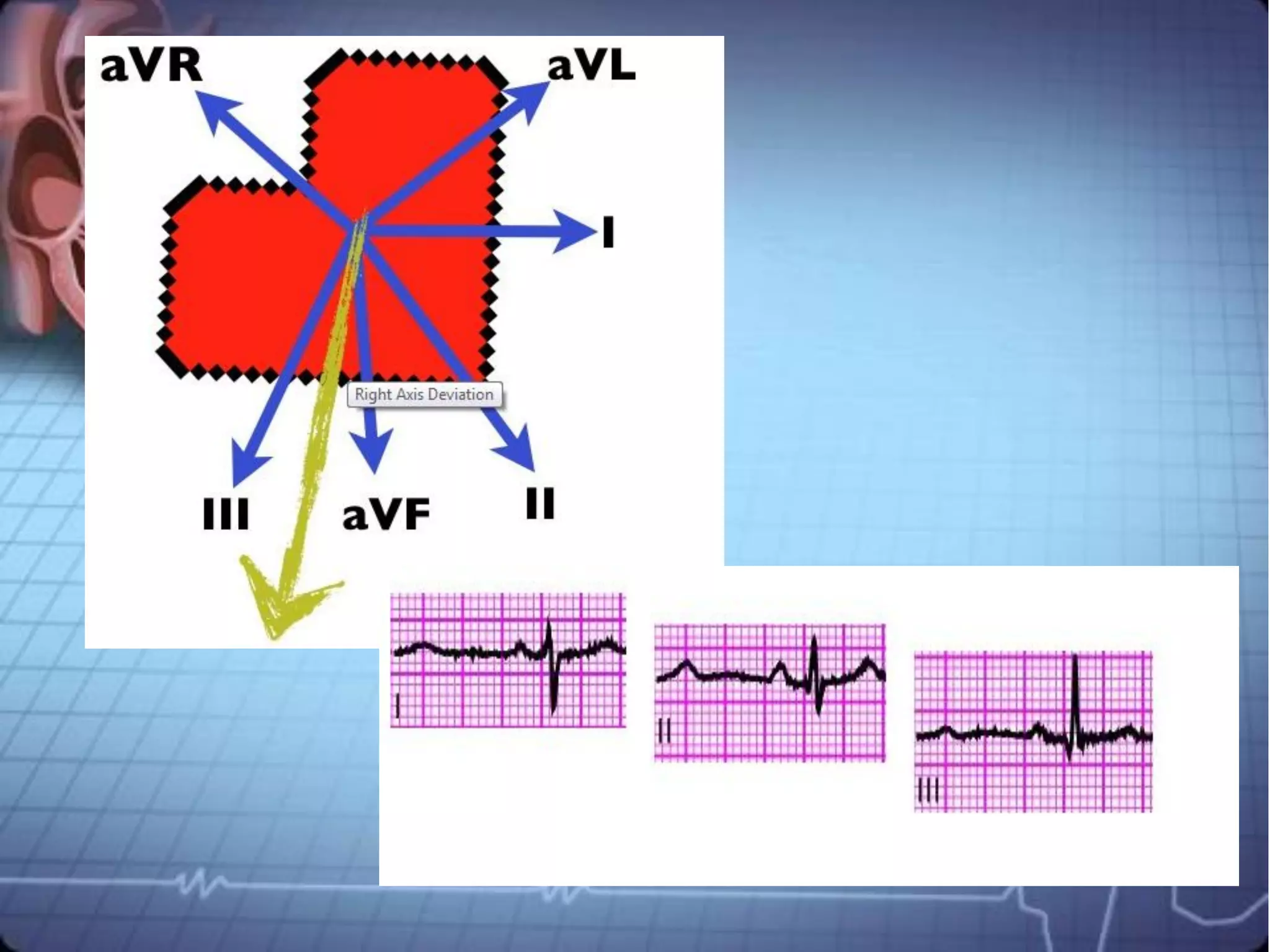 Basics of ECG physiology | PDF