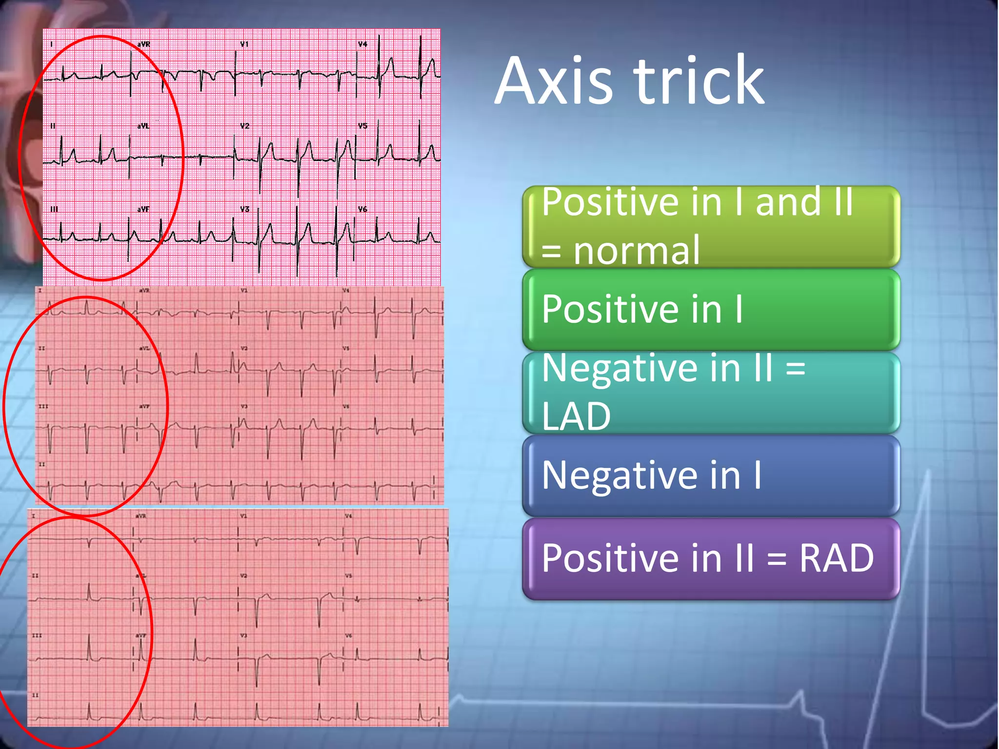 Basics of ECG physiology | PDF