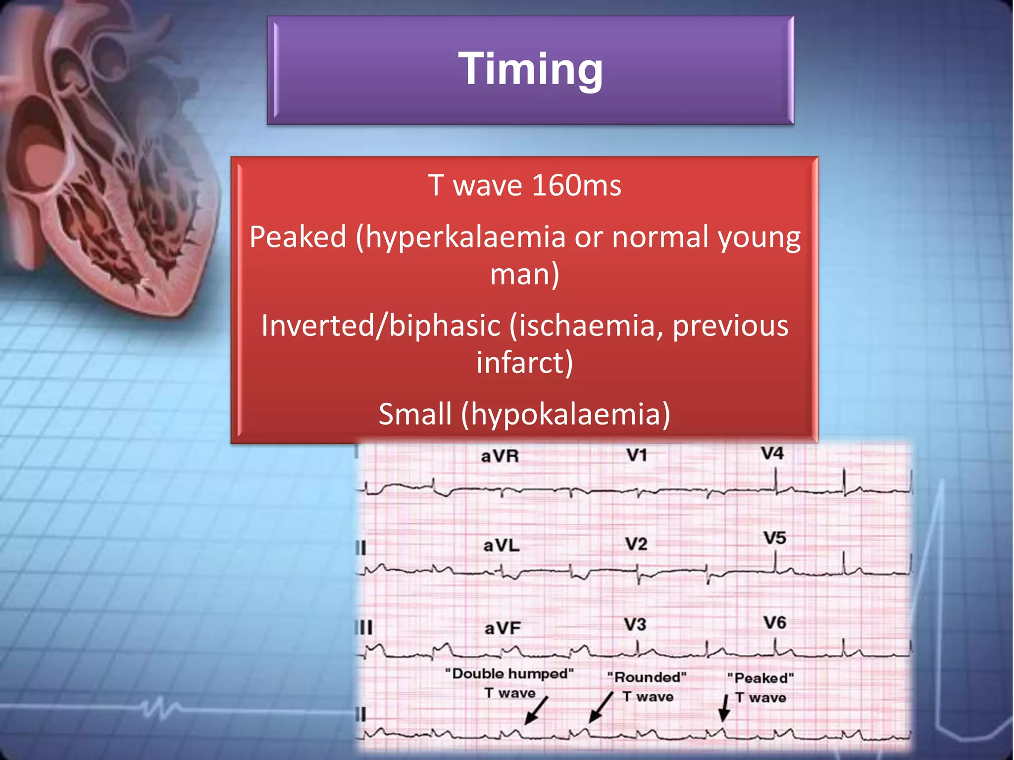 Basics of ECG physiology | PDF