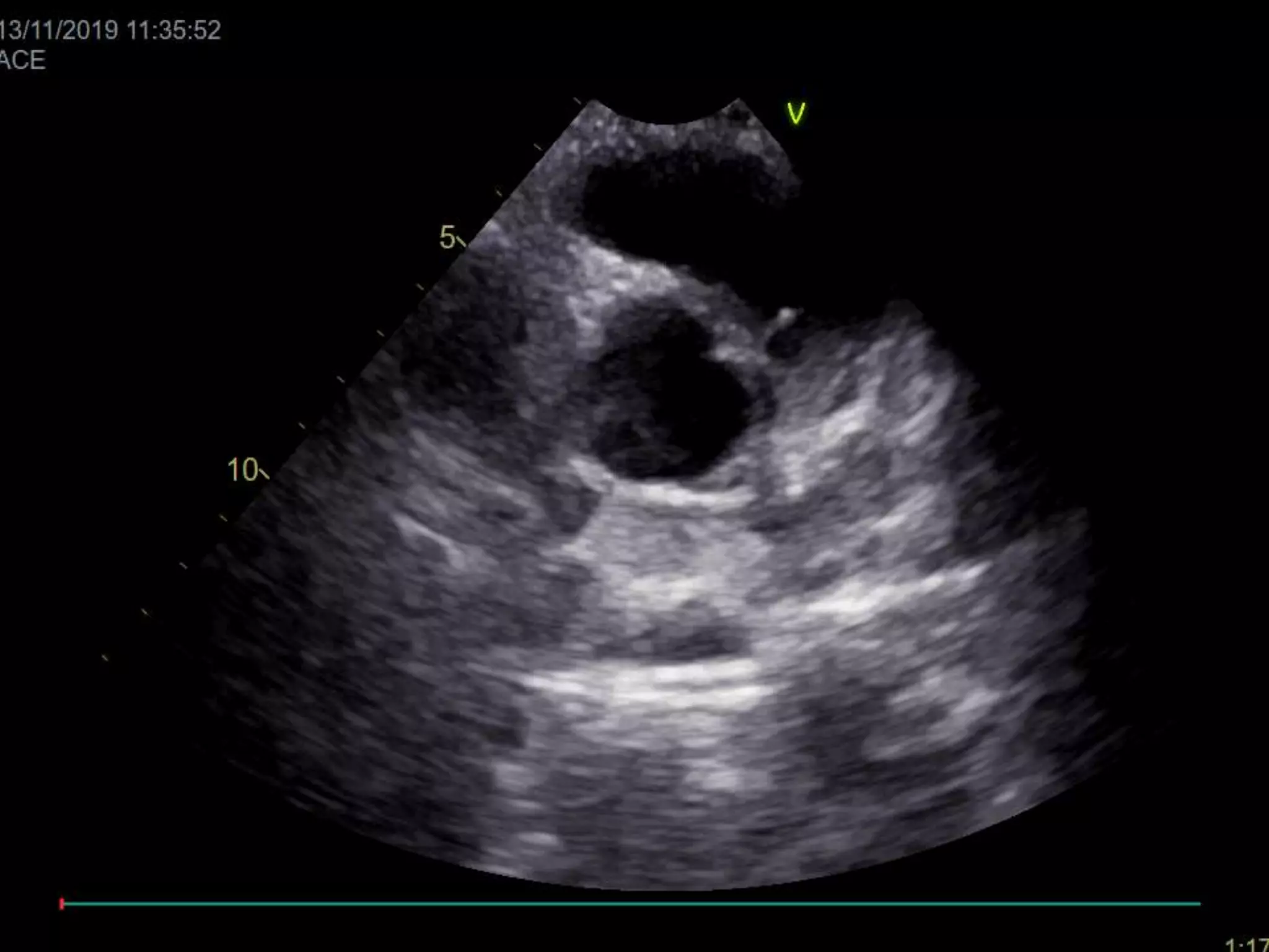 Basics of echo Cardiac Structure, Chamber quantifications & Artifacts.pptx