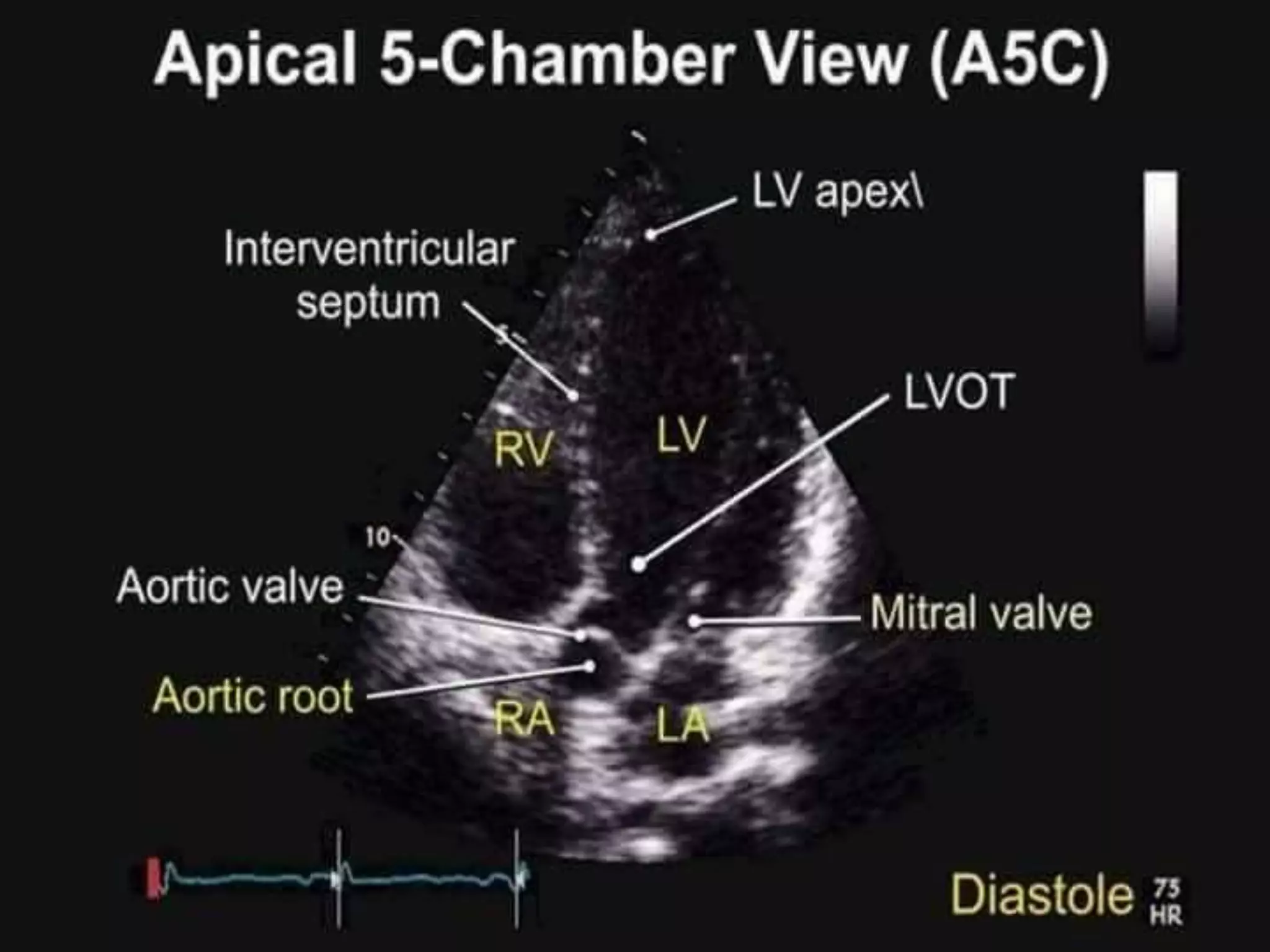 Basics of echo Cardiac Structure, Chamber quantifications & Artifacts.pptx