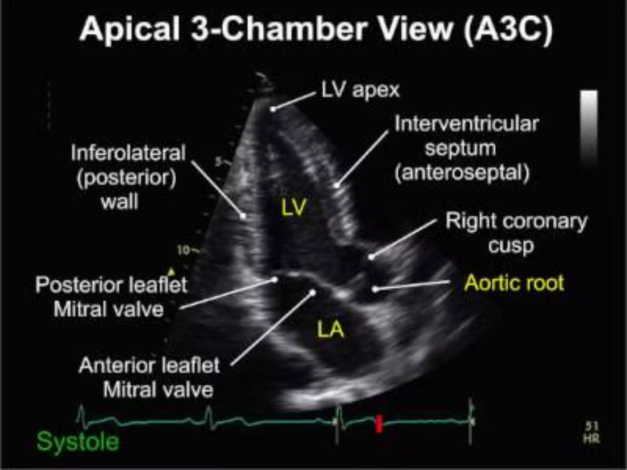 Basics of echo Cardiac Structure, Chamber quantifications & Artifacts.pptx