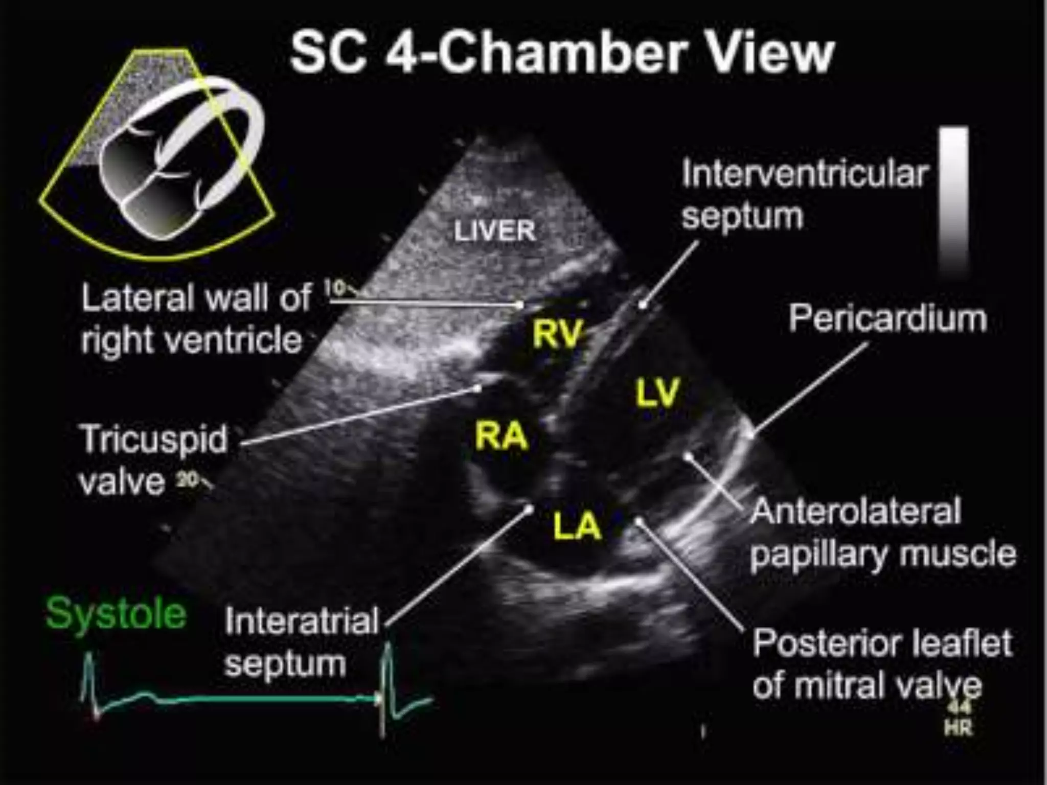 Basics of echo Cardiac Structure, Chamber quantifications & Artifacts.pptx