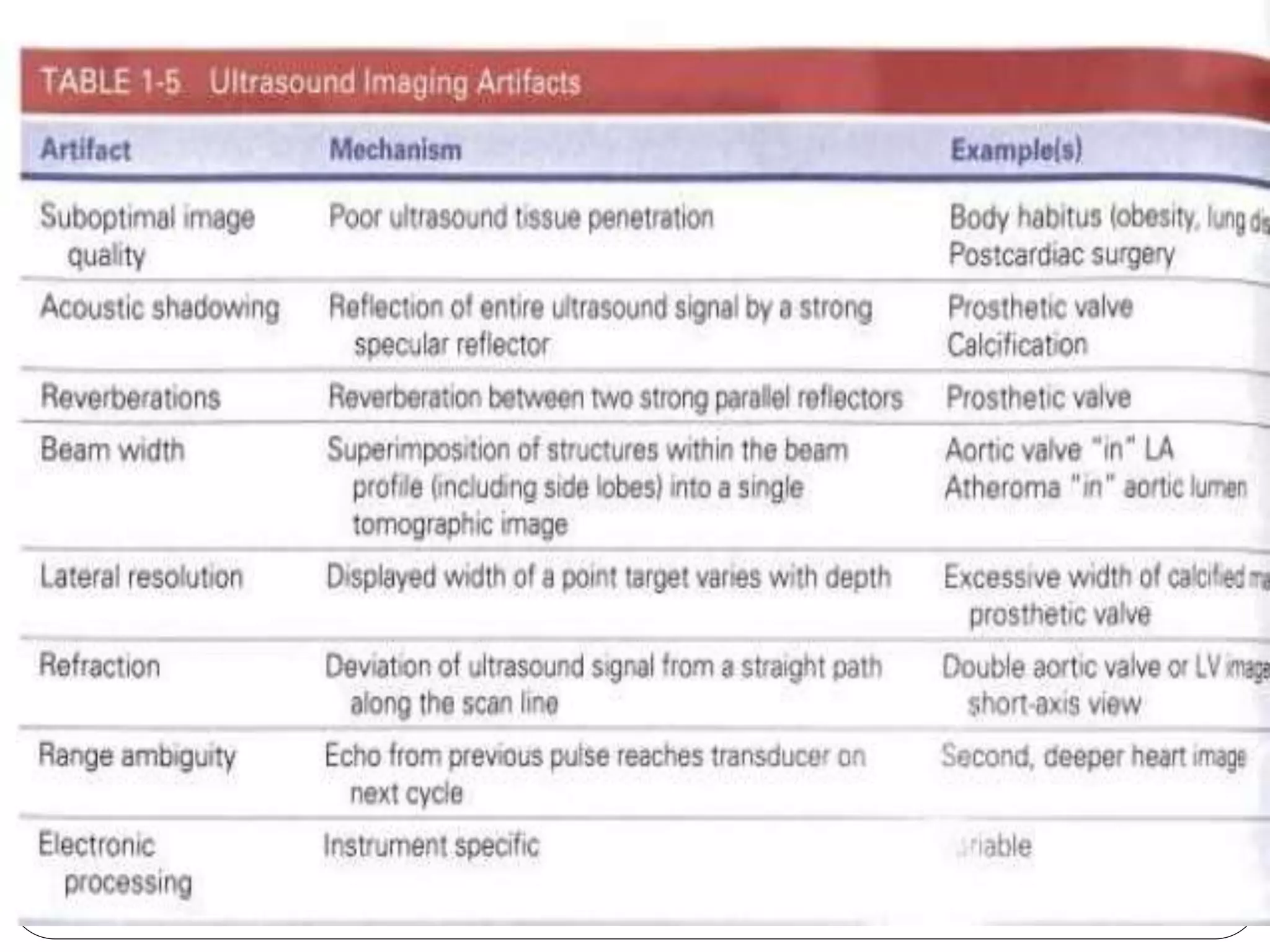 Basics of echo Cardiac Structure, Chamber quantifications & Artifacts.pptx