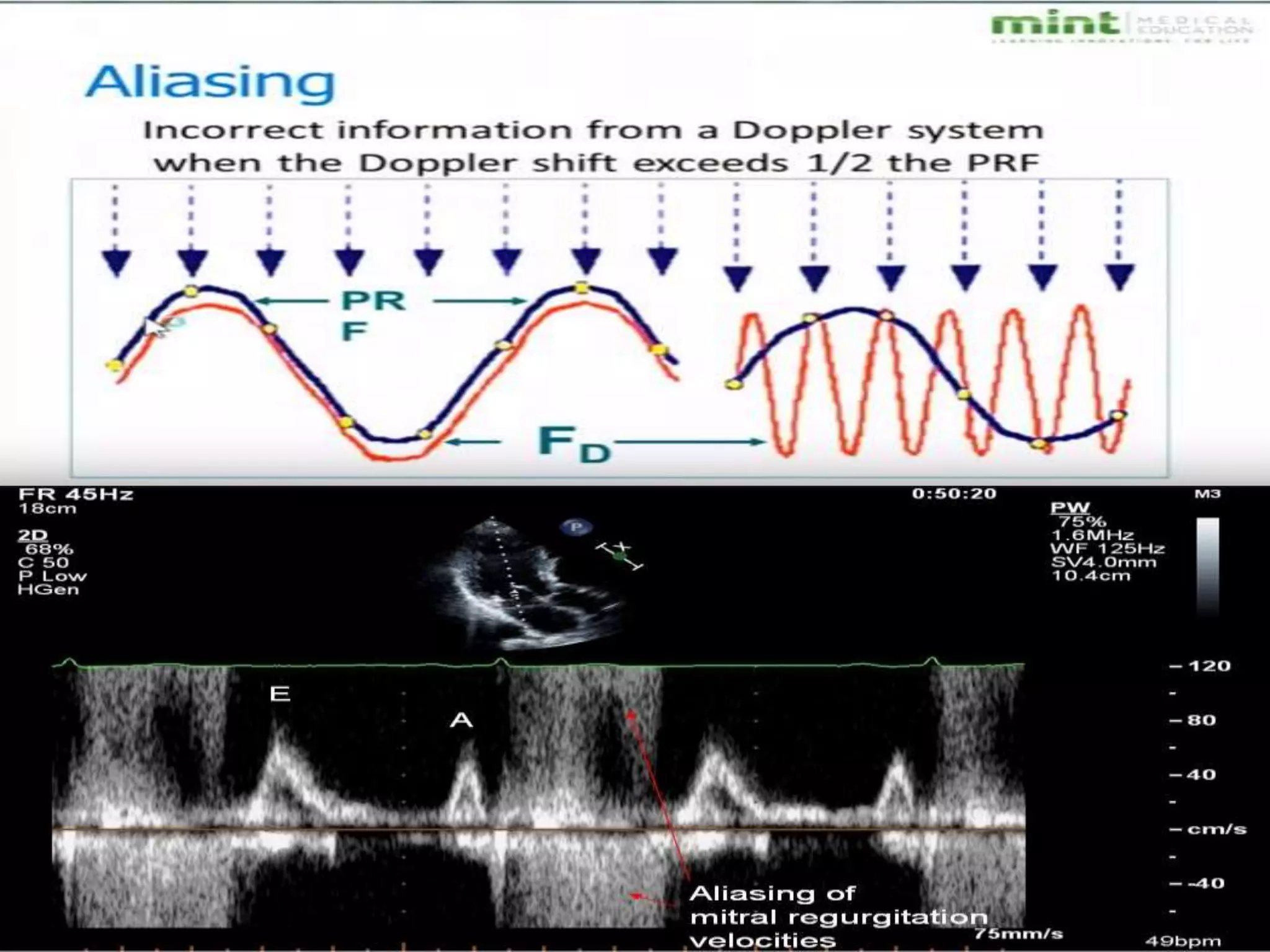 Basics of echo Cardiac Structure, Chamber quantifications & Artifacts.pptx