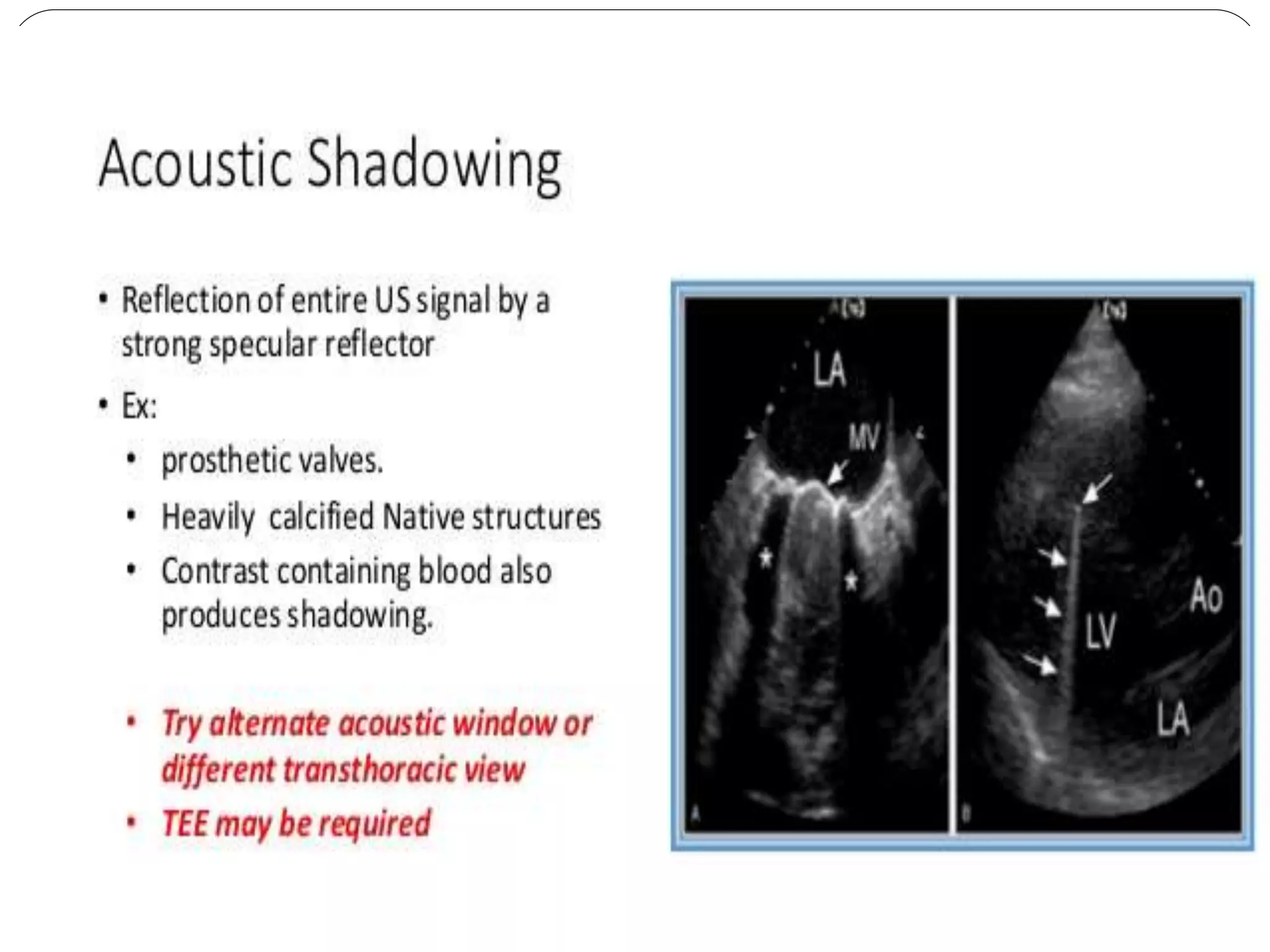 Basics of echo Cardiac Structure, Chamber quantifications & Artifacts.pptx
