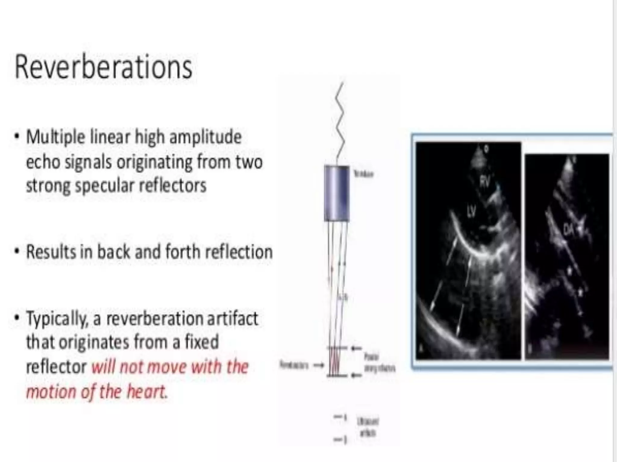 Basics of echo Cardiac Structure, Chamber quantifications & Artifacts.pptx