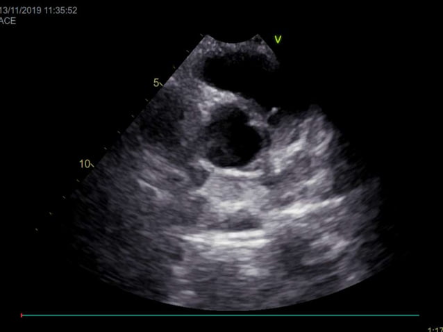 Basics of echo Cardiac Structure, Chamber quantifications & Artifacts.pptx | Digital Audio ...