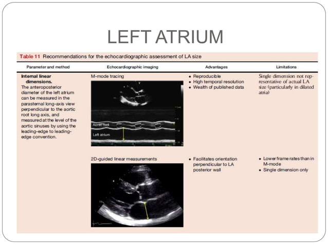 Basics of echo Cardiac Structure, Chamber quantifications & Artifacts.pptx | Digital Audio ...