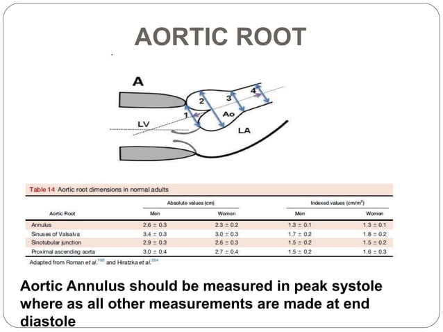 Basics of echo Cardiac Structure, Chamber quantifications & Artifacts.pptx | Digital Audio ...