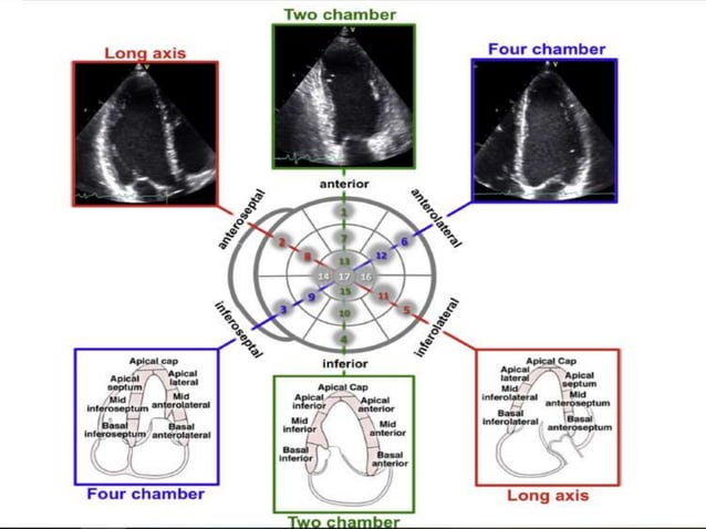 Basics of echo Cardiac Structure, Chamber quantifications & Artifacts.pptx | Digital Audio ...