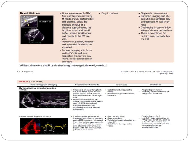 Basics of echo Cardiac Structure, Chamber quantifications & Artifacts.pptx | Digital Audio ...