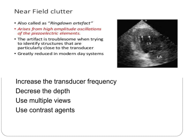 Basics of echo Cardiac Structure, Chamber quantifications & Artifacts.pptx | Digital Audio ...