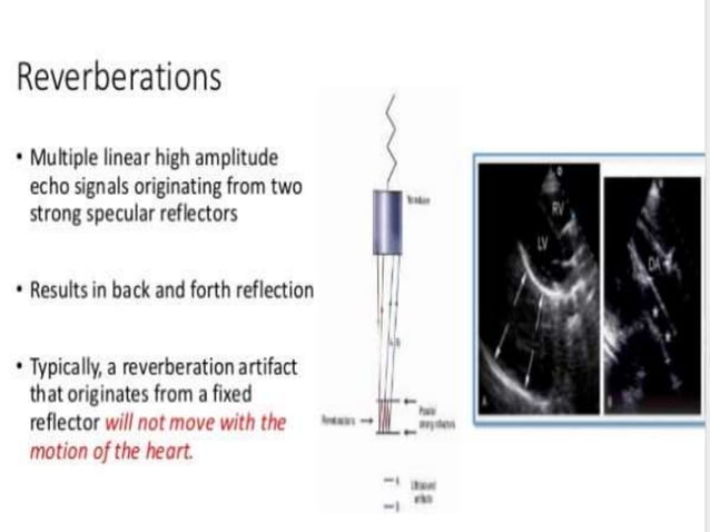 Basics of echo Cardiac Structure, Chamber quantifications & Artifacts.pptx | Digital Audio ...