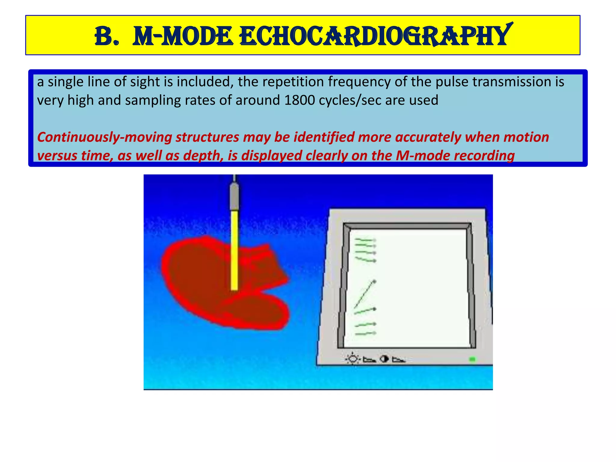 Basics of echo & principles of doppler echocardiography | PPTX | Heart and Cardiovascular ...