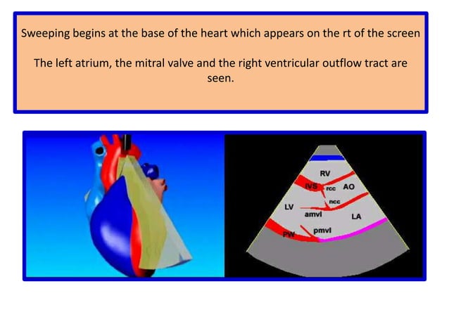 Basics of echo & principles of doppler echocardiography | PPTX | Heart and Cardiovascular ...