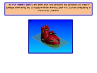 Basics of echo & principles of doppler echocardiography | PPTX