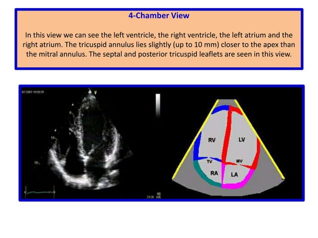 Basics of echo & principles of doppler echocardiography | PPTX | Heart ...
