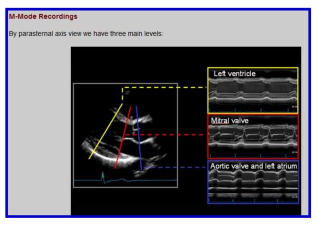 Basics of echo & principles of doppler echocardiography | PPTX | Heart ...