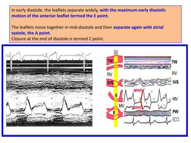 Basics of echo & principles of doppler echocardiography | PPTX | Heart ...